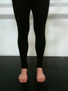 Bow Legged People